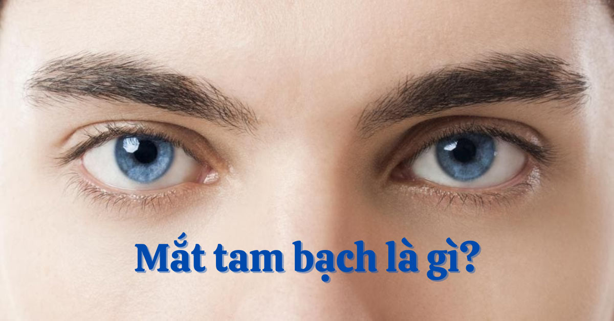 Mắt tam bạch là gì? Sở hữu mắt tam bạch tốt hay xấu?