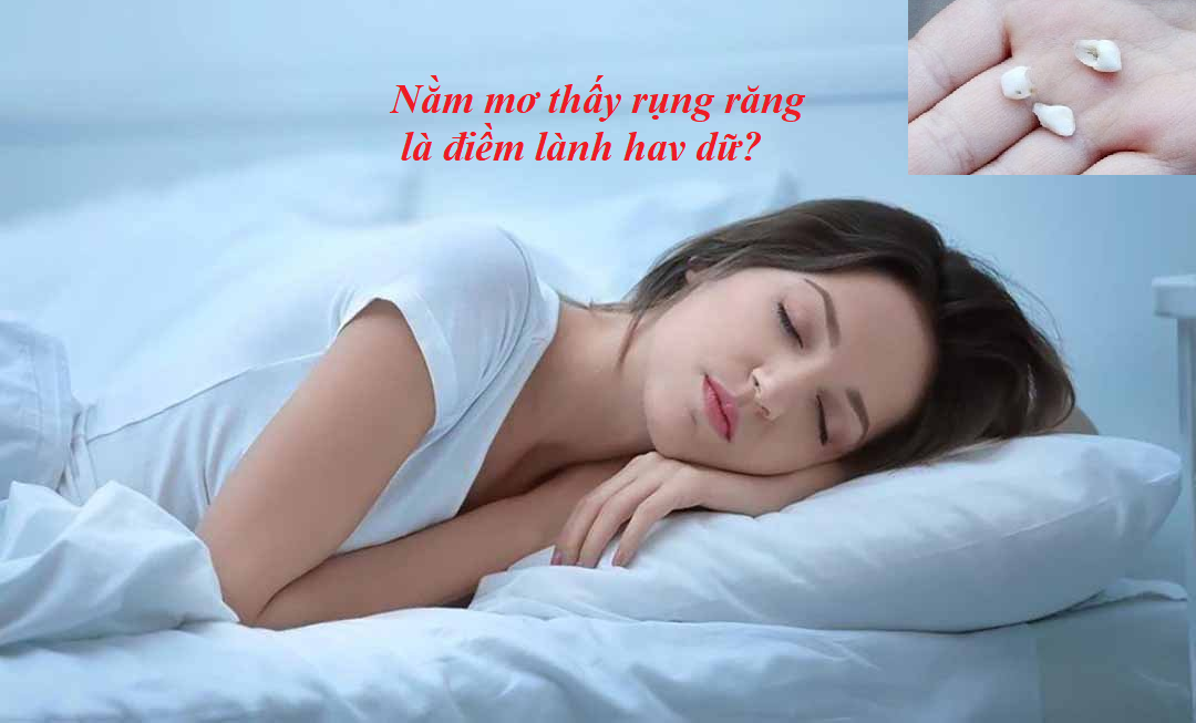 Nằm mơ thấy rụng răng là điềm tốt hay xấu?